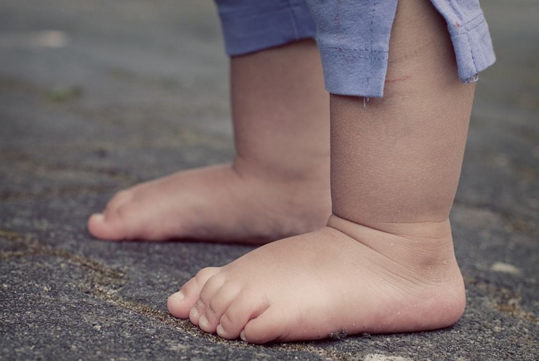 Baby develops scurvy after consuming plant-based diet