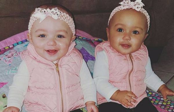 Nobody Believes Theyre Twins These Incredibly Rare Twins Are